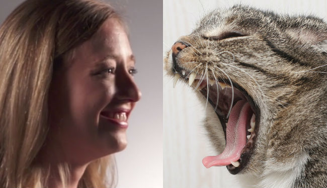 Video: Can Cat Poop Really Infect Human Brains?