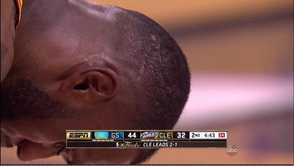 LeBron Whacked His Head On A Camera, Bled A Lot, But Stayed In