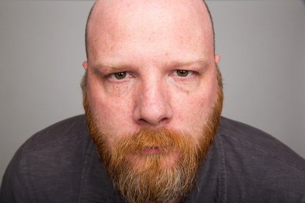 A Young Man's Guide To Going Bald