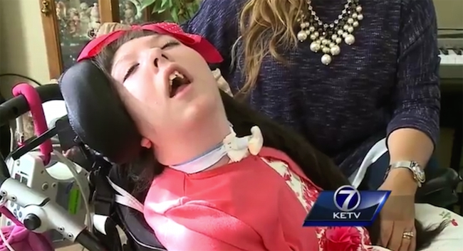 How Is This Girl With No Brain Still Alive At 10 Years Old?