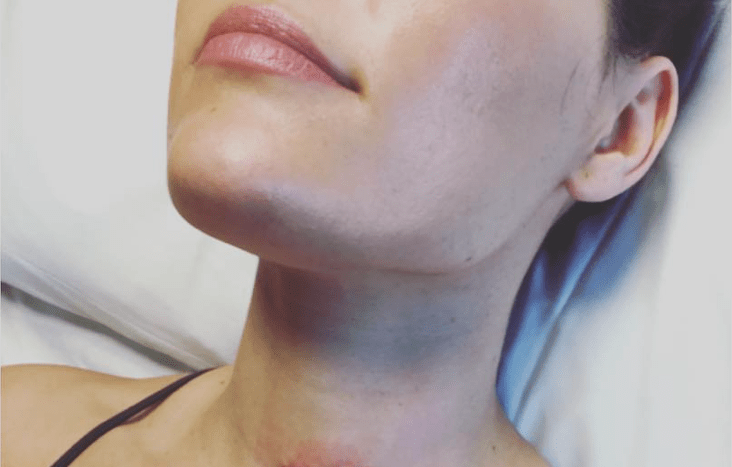Here's Nikki Bella's Scar From Major Neck Surgery