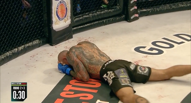 These Photos Of Cyborg Santos' Skull Fracture Are Brutal