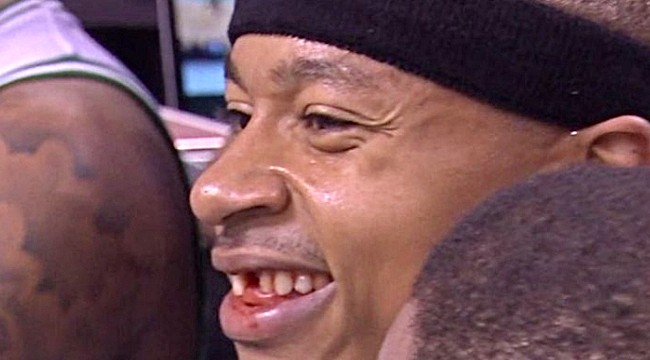 Isaiah Thomas Got A Tooth Knocked Out After An Elbow Caught His Mouth