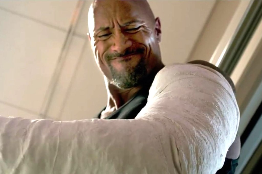 The Rock Shared List Of Injuries He's Recovered From Over The Years